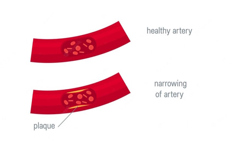Peripheral Arterial Disease Treatment Options for Healthier Legs