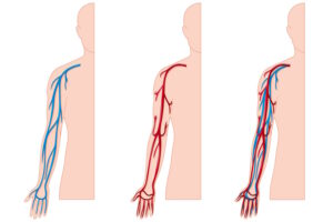 Veins vs. Arteries: What's the Difference? A Complete Guide