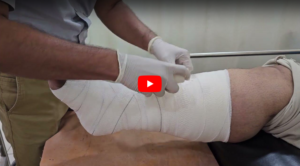 What is the Fastest Way to Heal a Leg Ulcer?